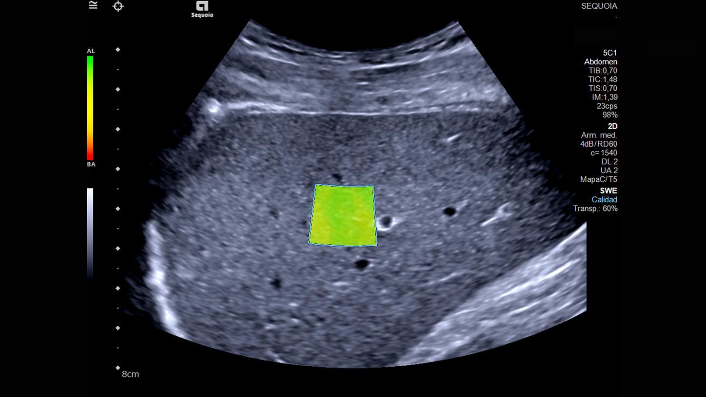 Personalized Ultrasound Solutions