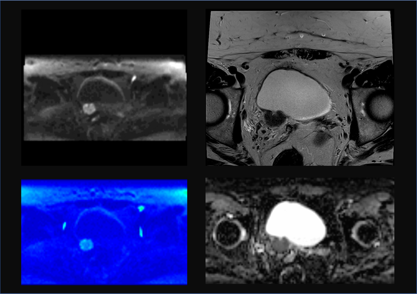 Introducing 3T MR Imaging with the New MAGNETOM Vida