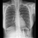 Twin Robotic X-ray scanner – Multitom Rax