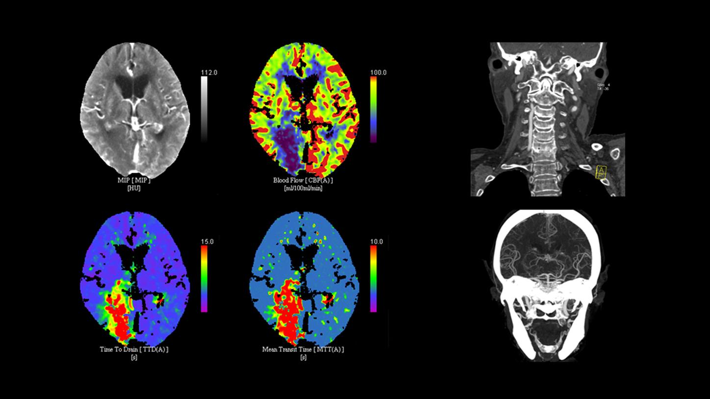 SOMATOM Definition Edge
