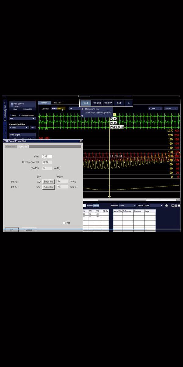 Rethink FFR assessment for every patient