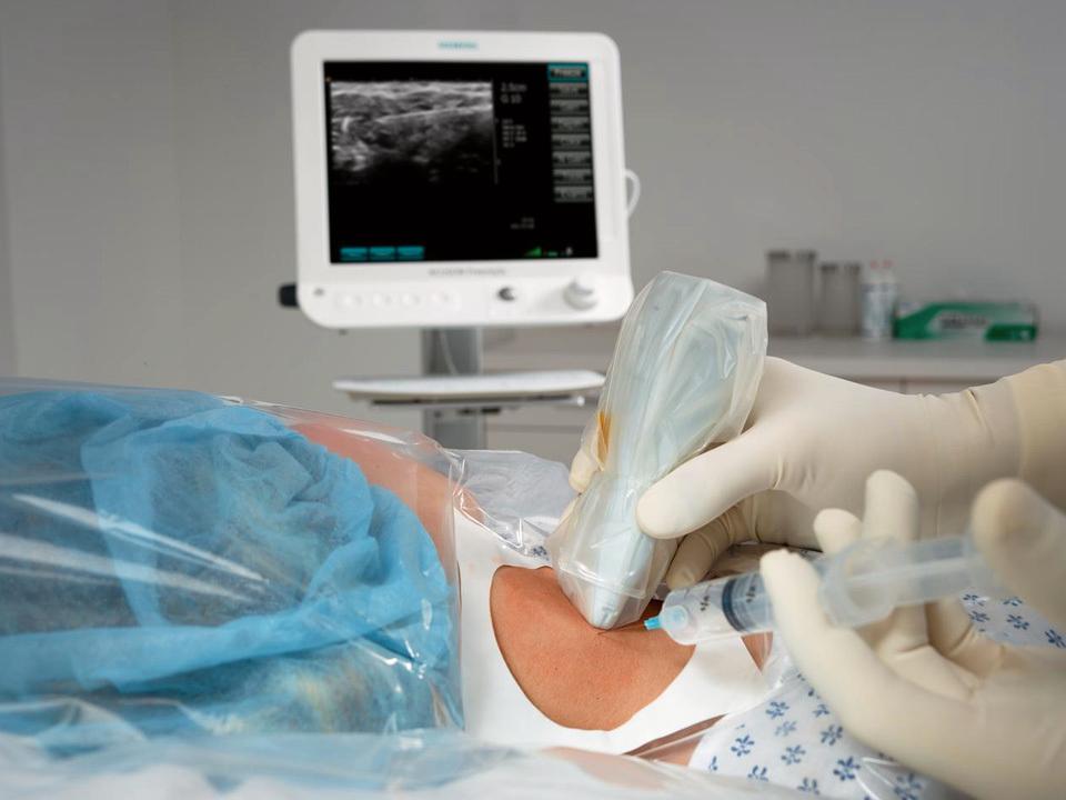 Wireless Ultrasound Transducers | ACUSON Freestyle