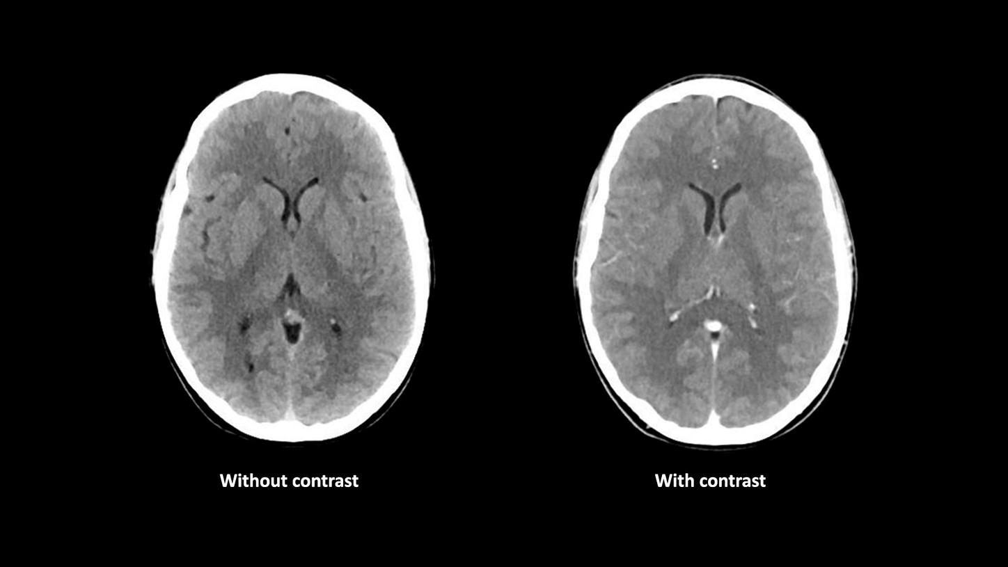 SOMATOM Definition Edge