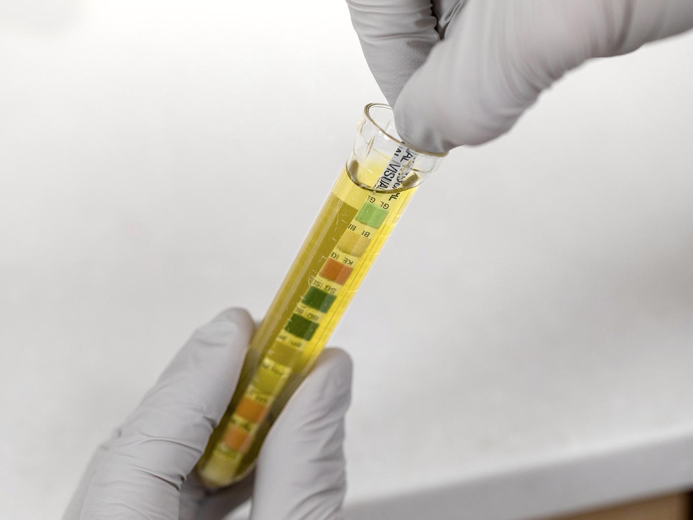 Point of Care Diagnostics