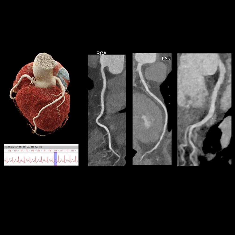 CT Cardiovascular imaging