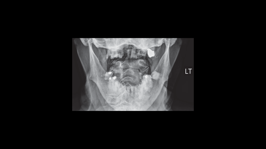 The use of SPECT/CT in a musculoskeletal Physical Medicine and ...