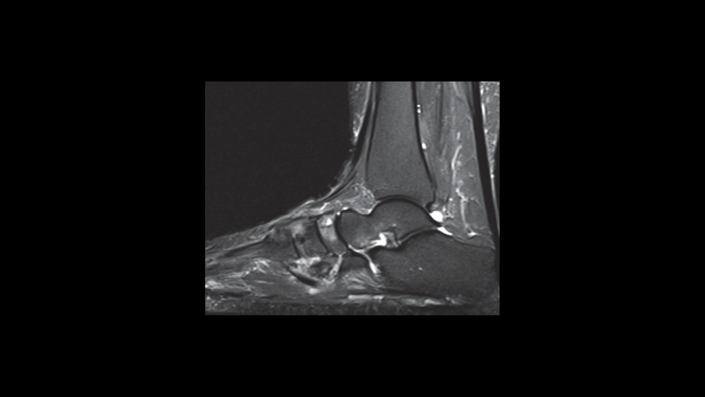 The use of SPECT/CT in a musculoskeletal Physical Medicine and ...