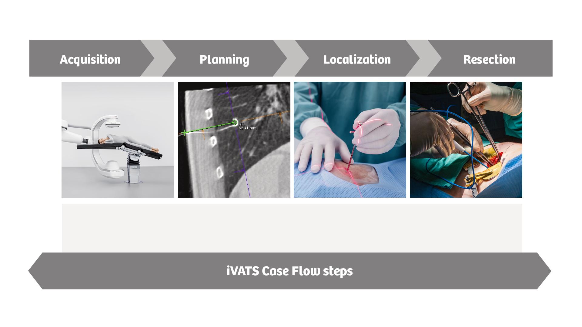 iVATS in the Hybrid OR