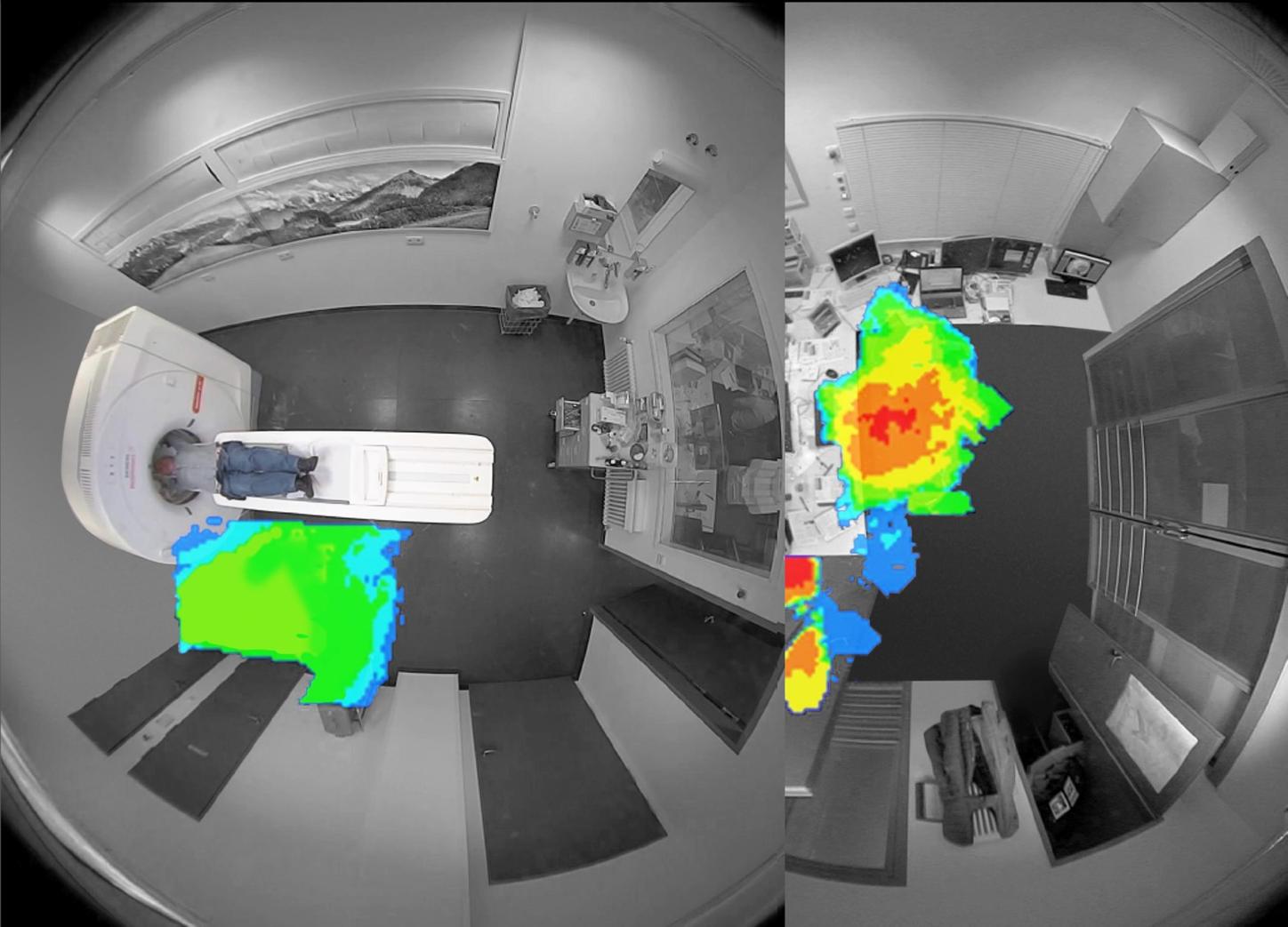 SOMATOM go.Now with myExam Companion