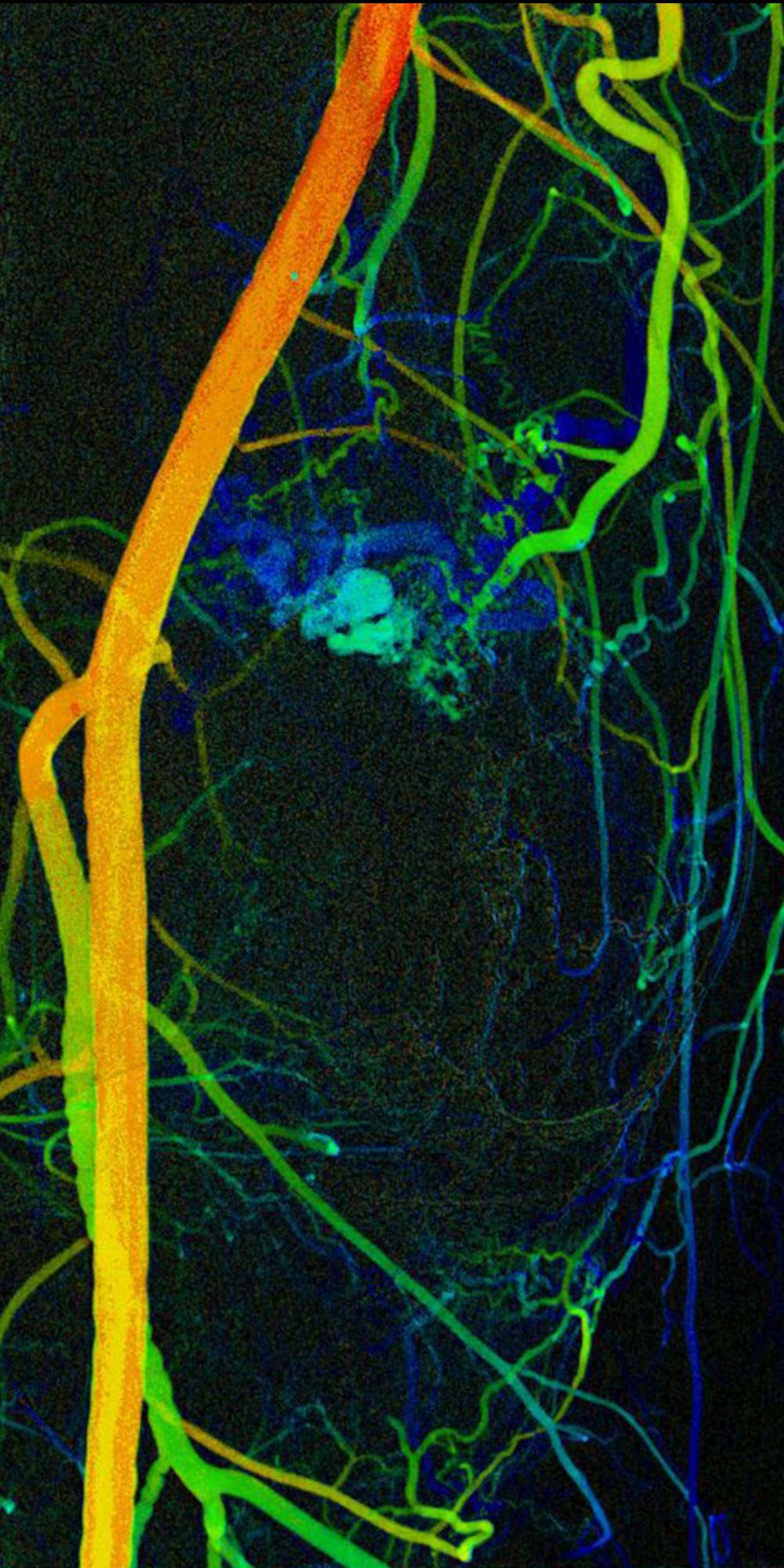 ARTIS icono – Angiography System – Siemens Healthineers