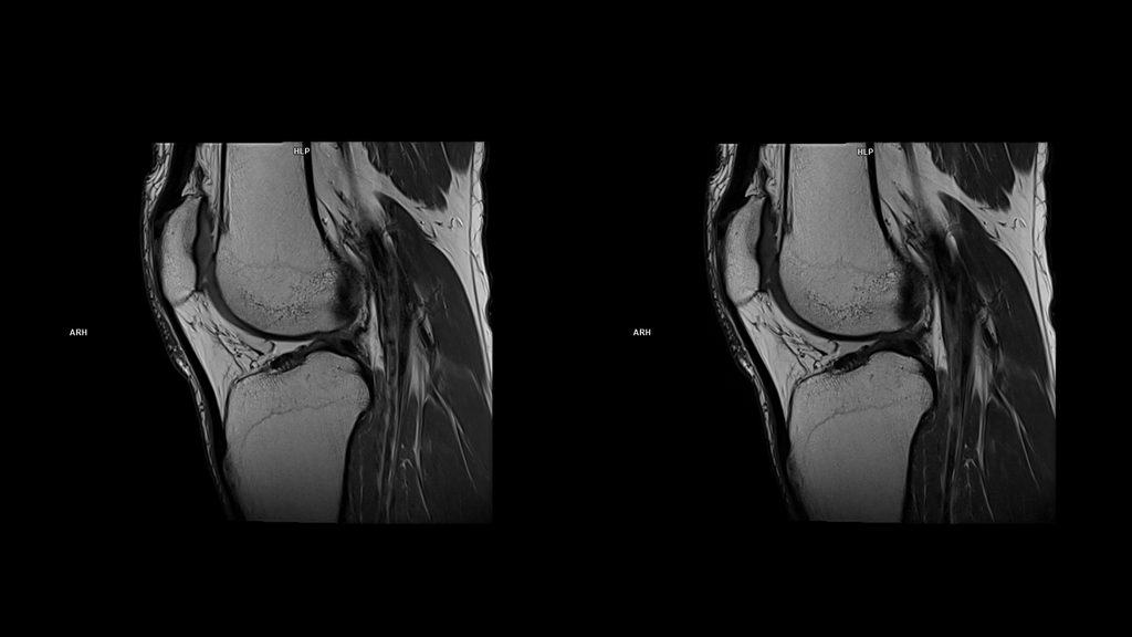 MAGNETOM Prisma - MRI Scanner