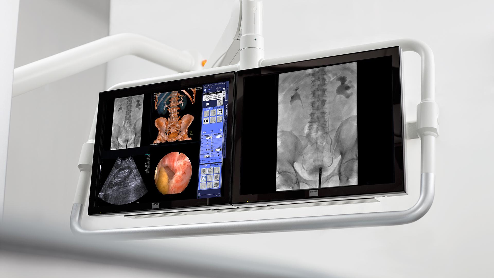 Urology device Uroskop Omnia Max