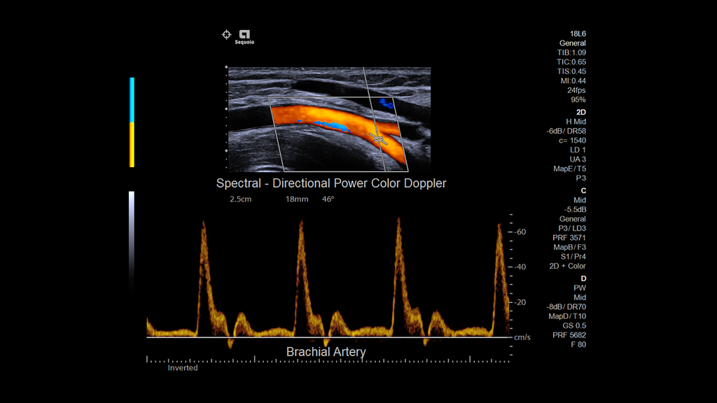 ACUSON Sequoia Ultrasound System