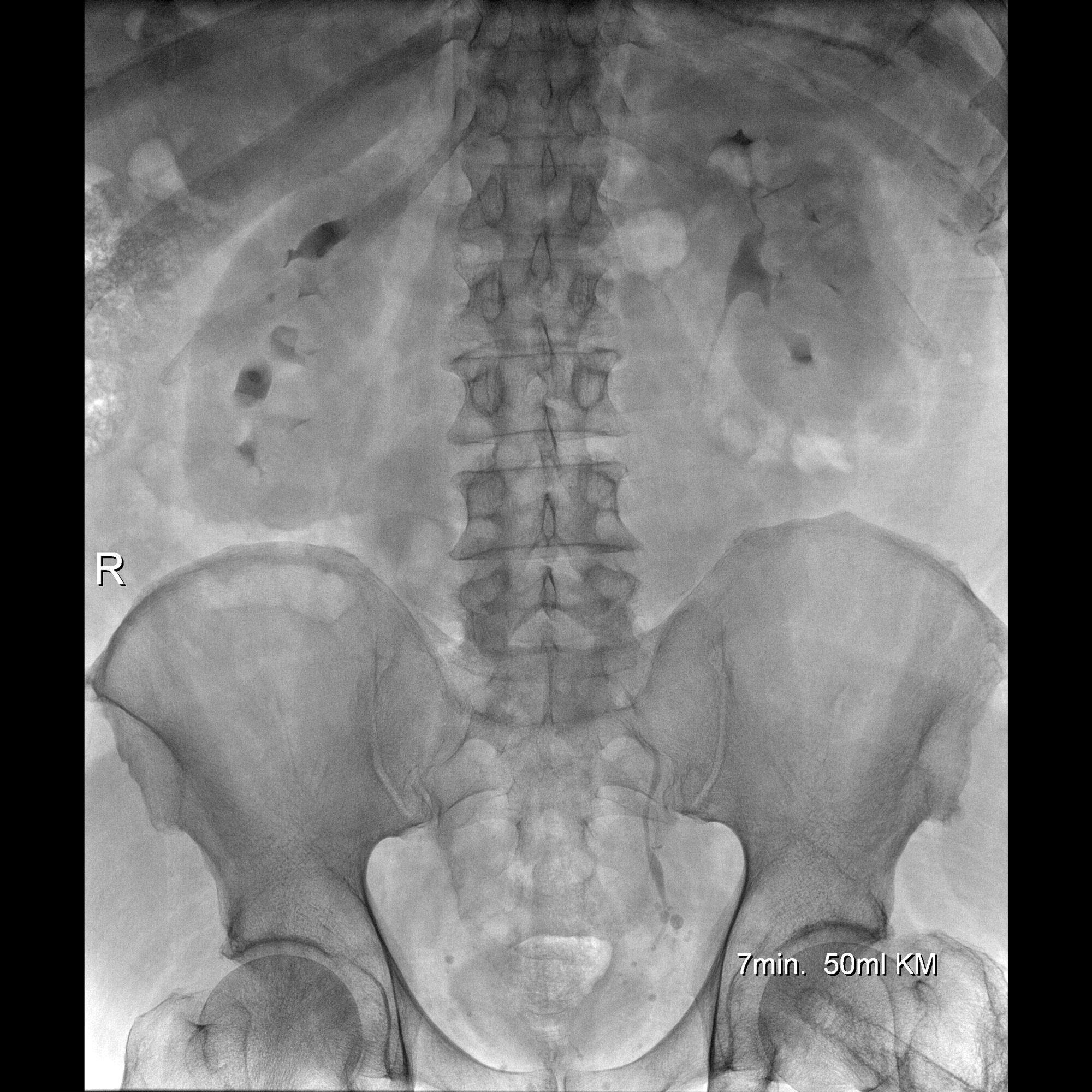 Urology device Uroskop Omnia Max