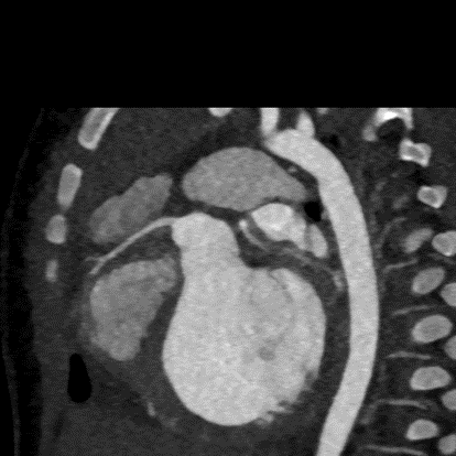 Pediatric Computed Tomography Solutions