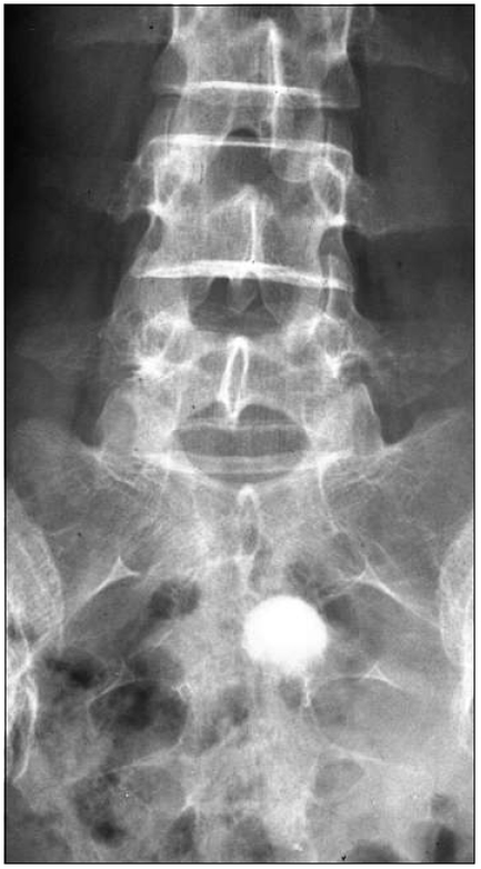 MUM – Muskuloskelettales Universitätszentrum München | Osteom