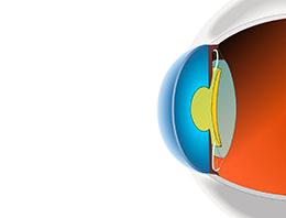 Phake Intraokular-Linsen (PIOL) | Augenklinik und Poliklinik