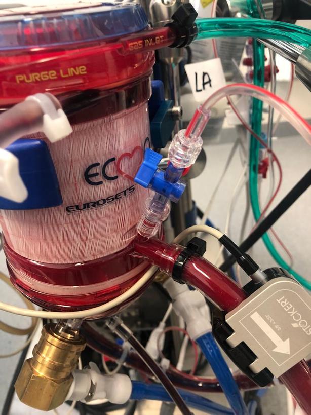 Extrakorporale Zirkulationsverfahren in der perioperativen Medizin und Intensivmedizin | Klinik ...