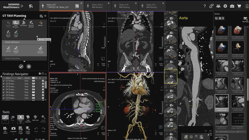 Demo Worlds First Photon Counting Ct