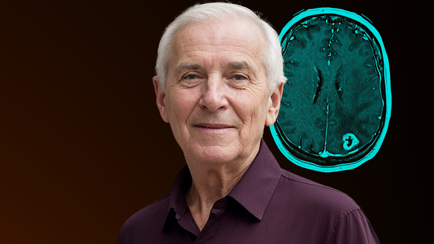 Pathway of George - Brain metastases journey