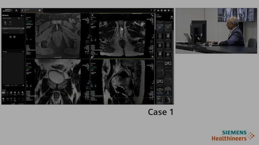 A practical approach to Prostate Magnetic Resonance Imaging (MRI) interpretation