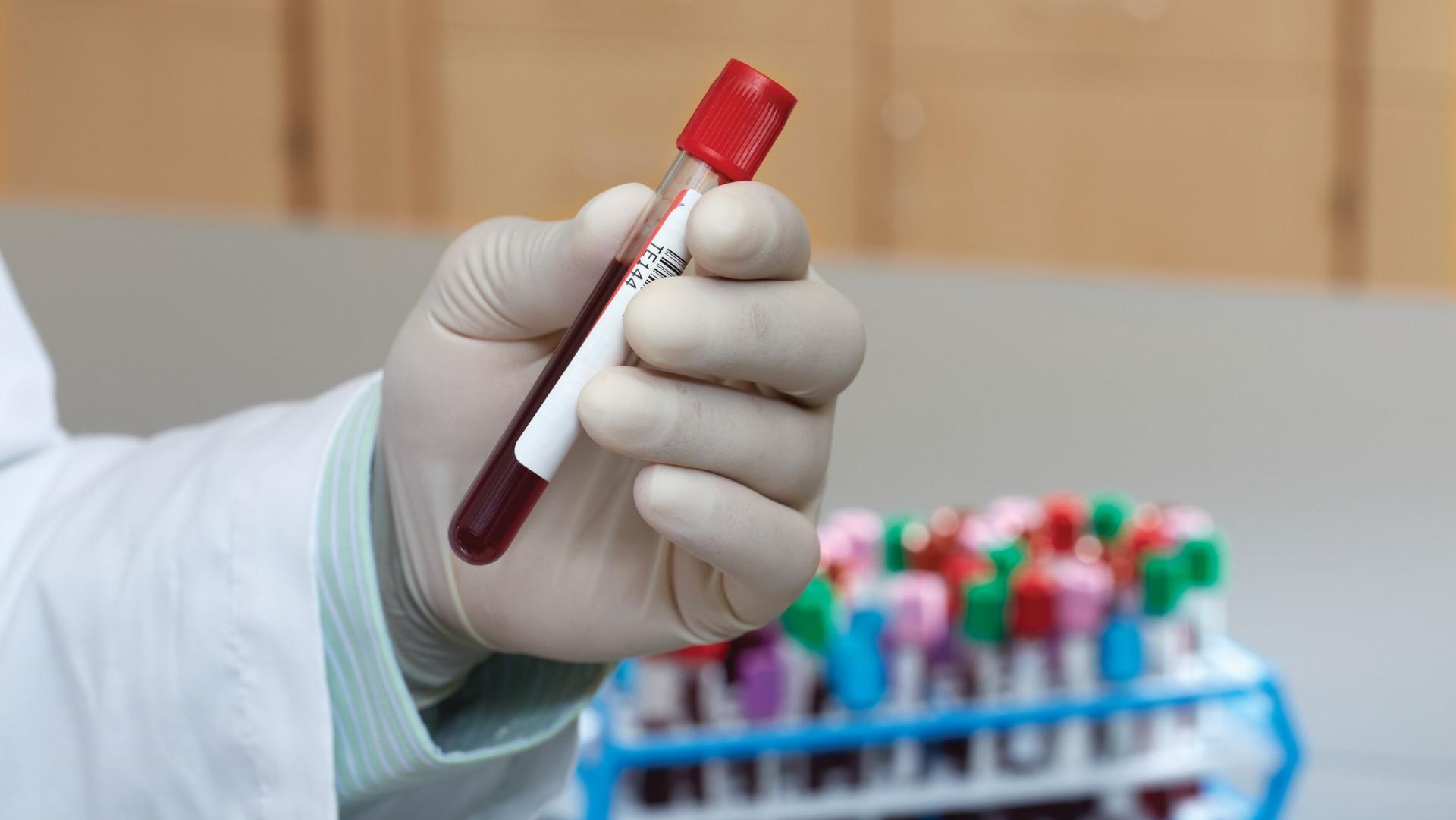 ELF: The First of its Kind Blood Test for Patients with Advanced ...