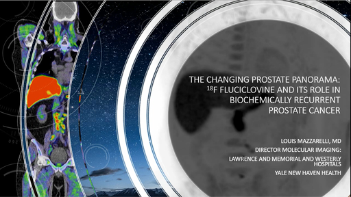 Webinar - The Value of PET/CT in Radiation Therapy