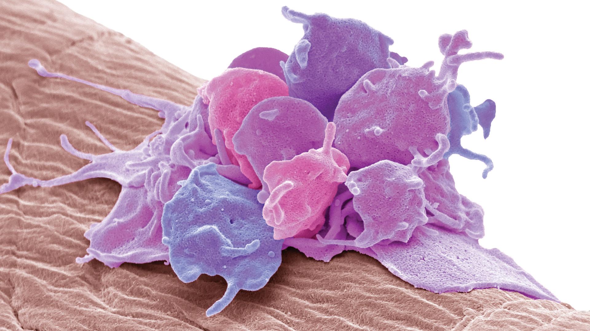 ISTH 2026 - Paris, France - Siemens Healthineers