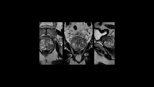 A practical approach to Prostate Magnetic Resonance Imaging (MRI) interpretation: an interactive ...