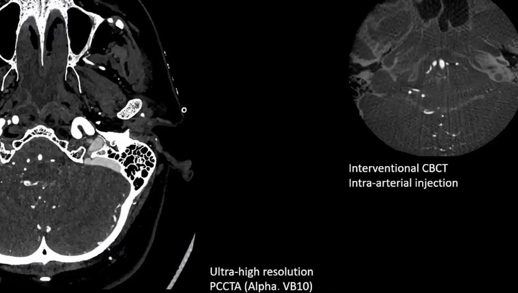 Clinical advancements in CT imaging for next-generation technology