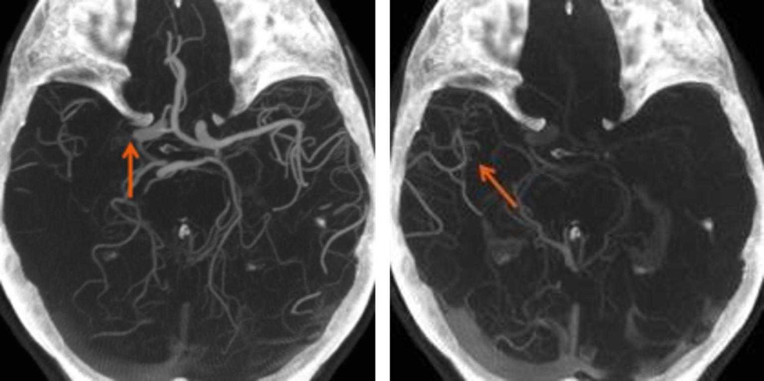 Siemens Healthineers Shape 21 RSNA Experience