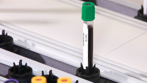 Video case study: Data and automation revolutionize Dr. Lal Pathlabs