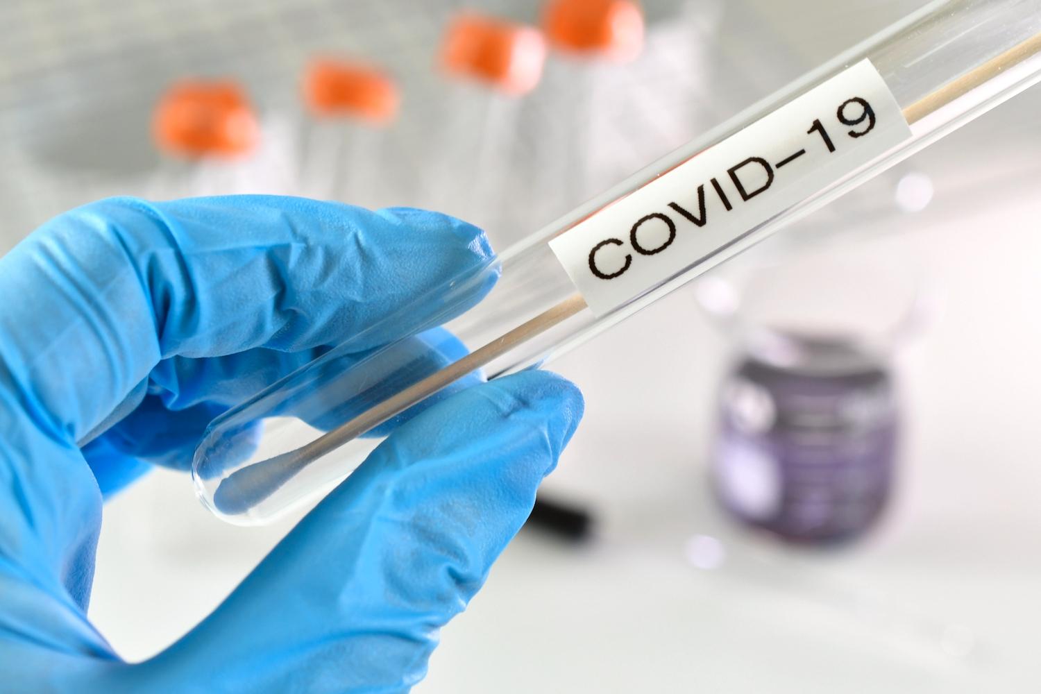 Corona-Schnelltests am Airport