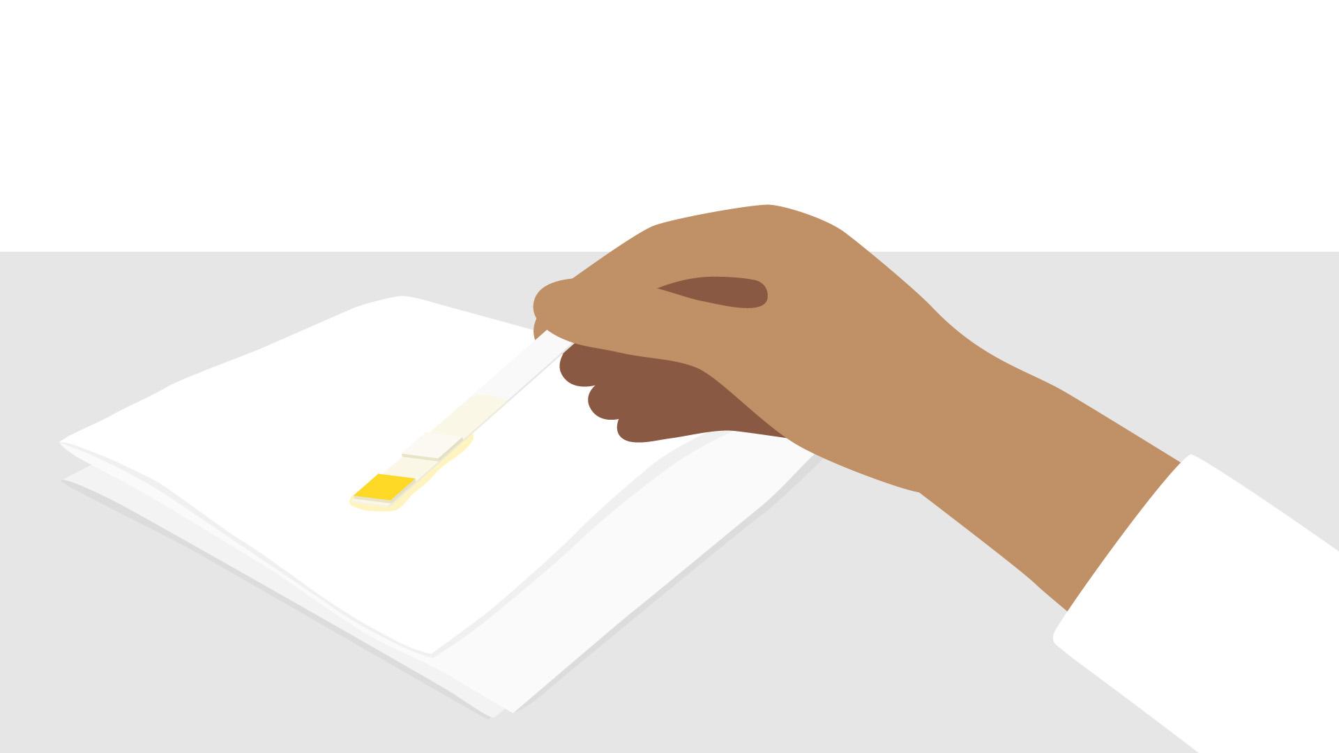 Clinistix At Home Kidney Tests | Siemens Healthineers