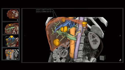 医疗数据可视化